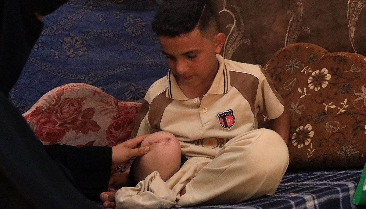 Limbs of Hope | MATW Project